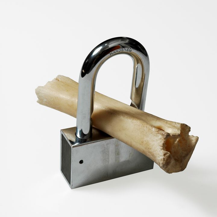 osteoporosis Lock and bone - PhotoStock-Israel - Photography, Science ...