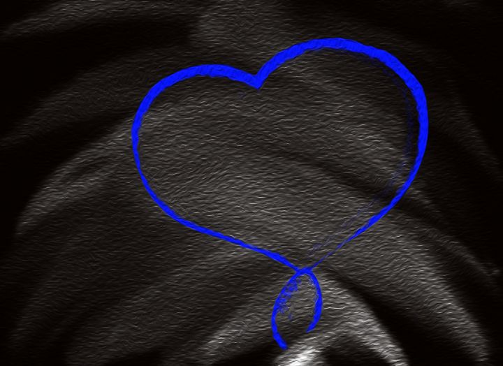 Heart - Shattered Ink WA by Paint Girl - Digital Art, Abstract, Other ...