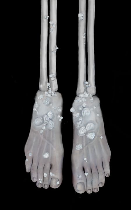 Barnacle Feet - Support Group for Introverts - Paintings & Prints ...