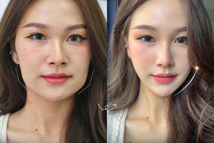 Facial care - Robyn Lederman - Photography, People & Figures, Female Form, Other Female Form ...